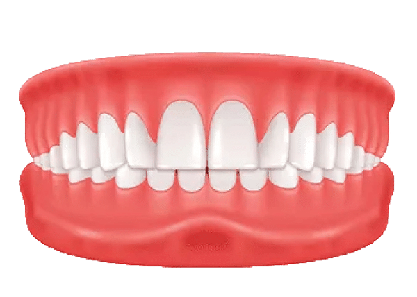 Best braces in Al Rigga | Smile Story Medical Center
