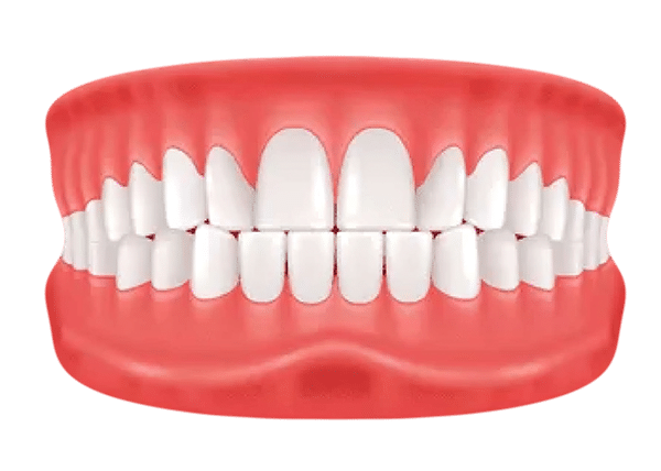 Best braces in Al Rigga | Smile Story Medical Center